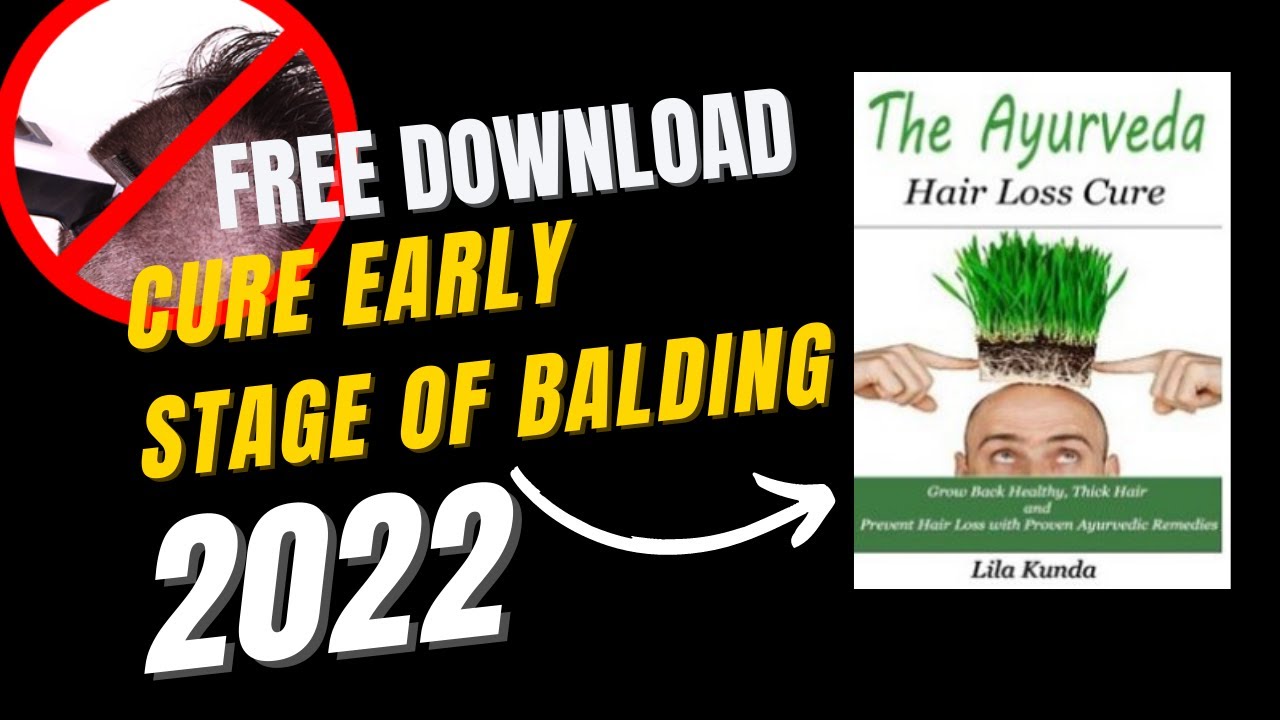 7 Stages Of Balding | Norwood Scale | Male ... | Humix Video
